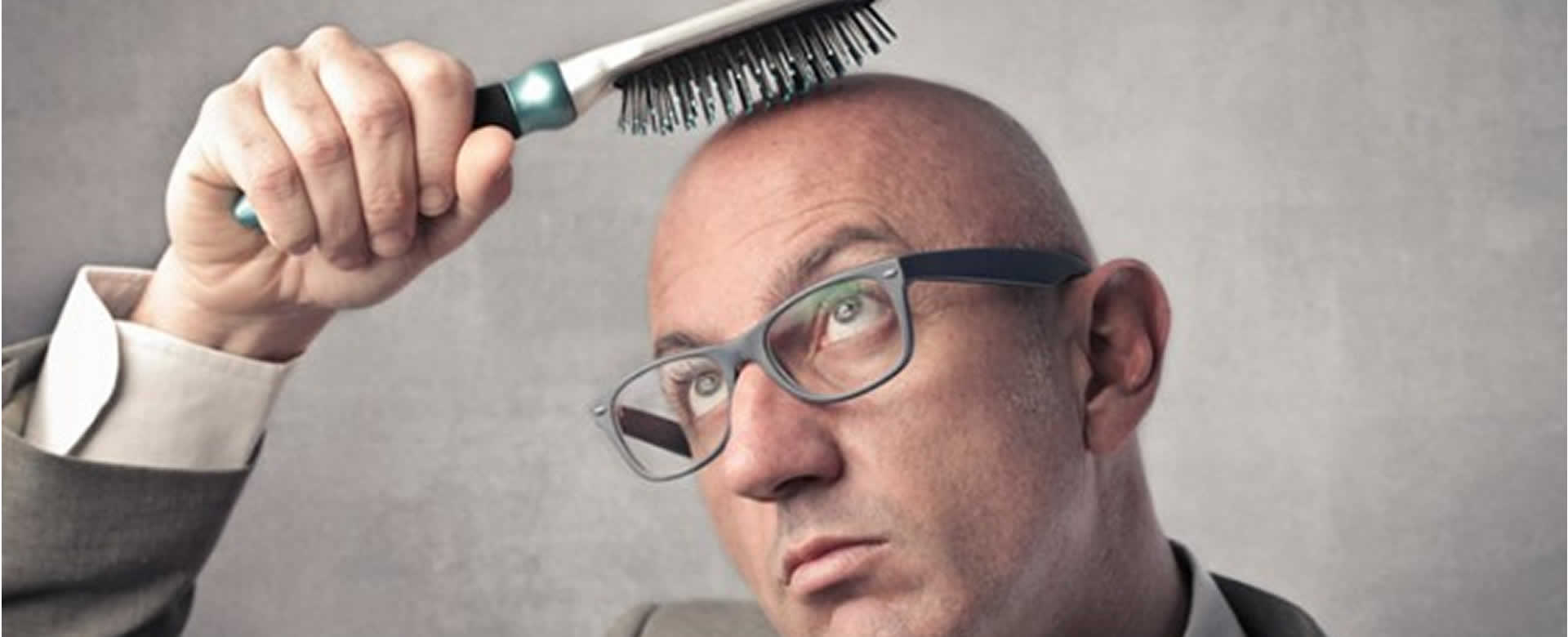 Conocé algunas divertidas ventajas de ser calvo : Viva Nicaragua Canal 13